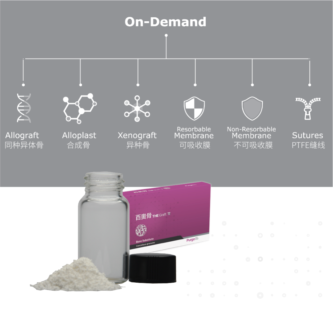 松柏投资控股骨再生领军企业Purgo 携手全球合作网络发展再生产业 - 松佰牙科